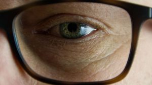 Can Glasses Fix A Lazy Eye? 7 Powerful Facts You Need To Know - Skillsoon