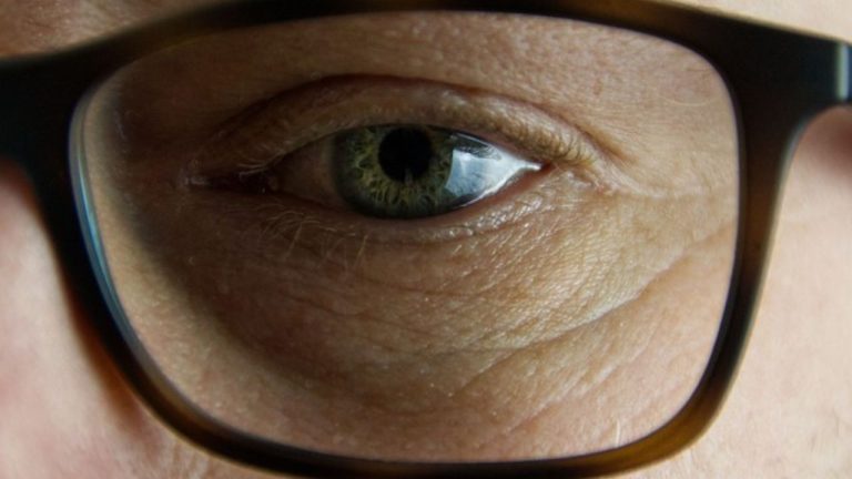 Can Glasses Fix A Lazy Eye? 7 Powerful Facts You Need To Know - Skillsoon