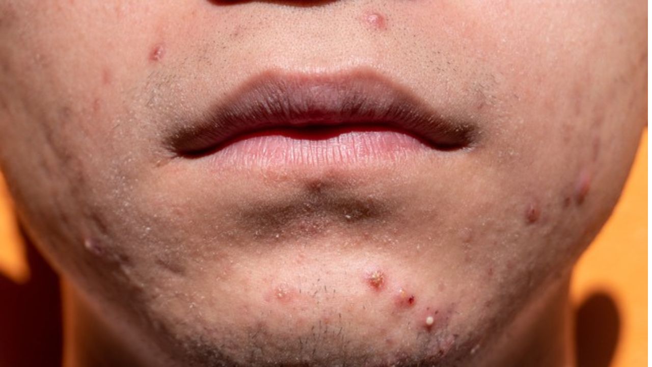 10 Powerful Effects Of Peanuts On Females You Need To Know - Skillsoon