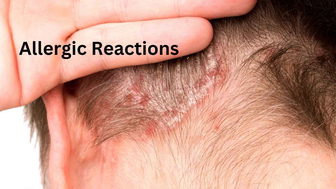 Head Itching No Lice? 7 Powerful Causes And Effective Treatments ...